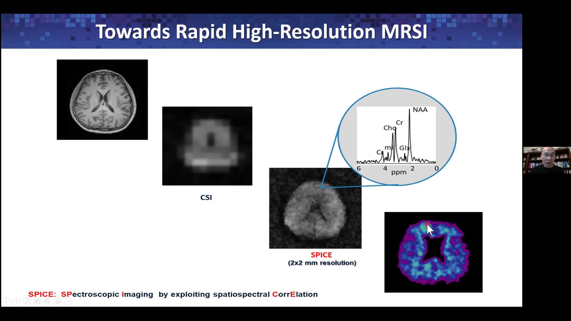 上科大生医工学术讲座实录——分子影像和自旋：通过子空间学习实现高分辨率成像