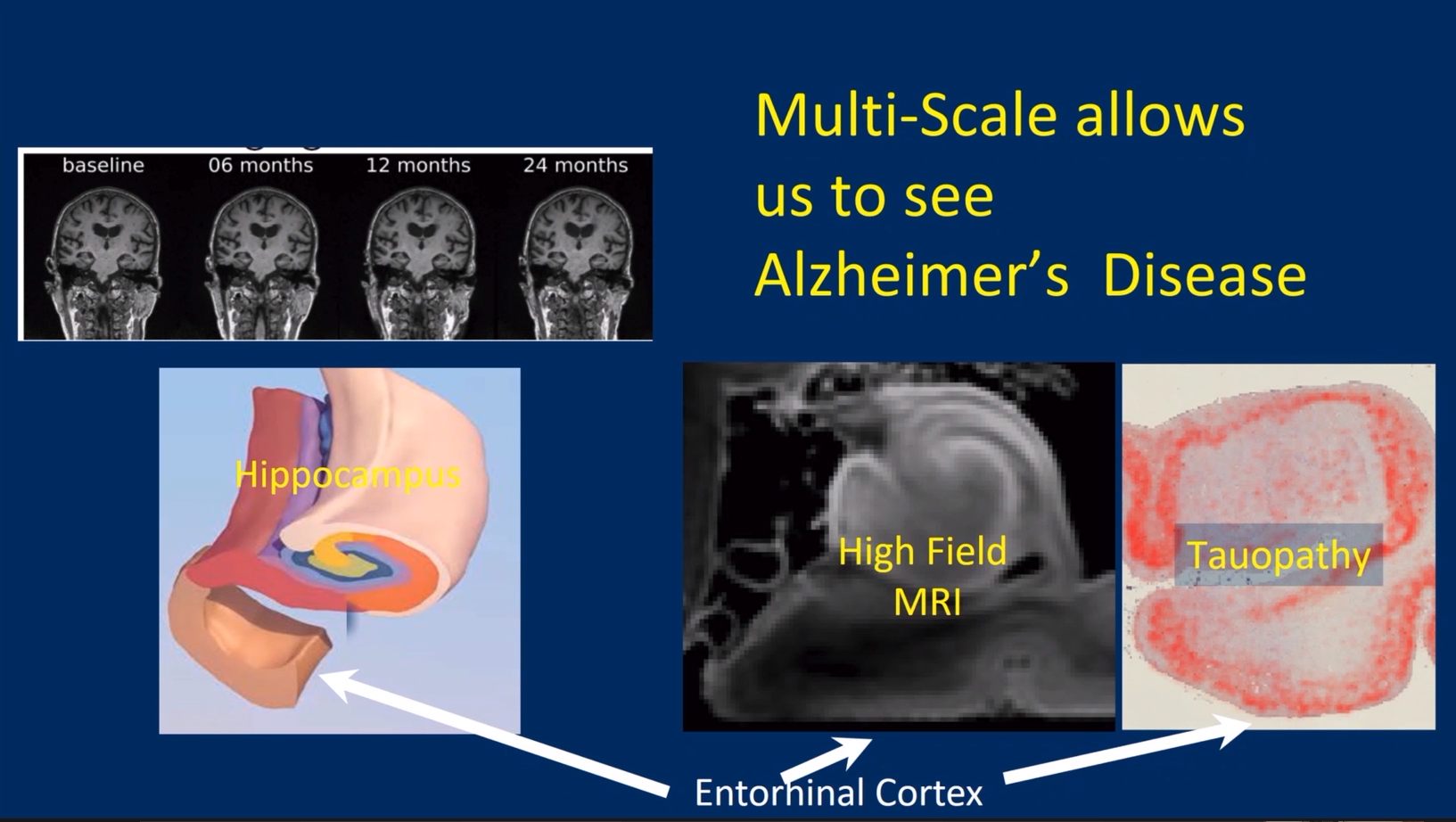 上科大生医工在线学术讲座实录：分层计算解剖学和 BME 2.0